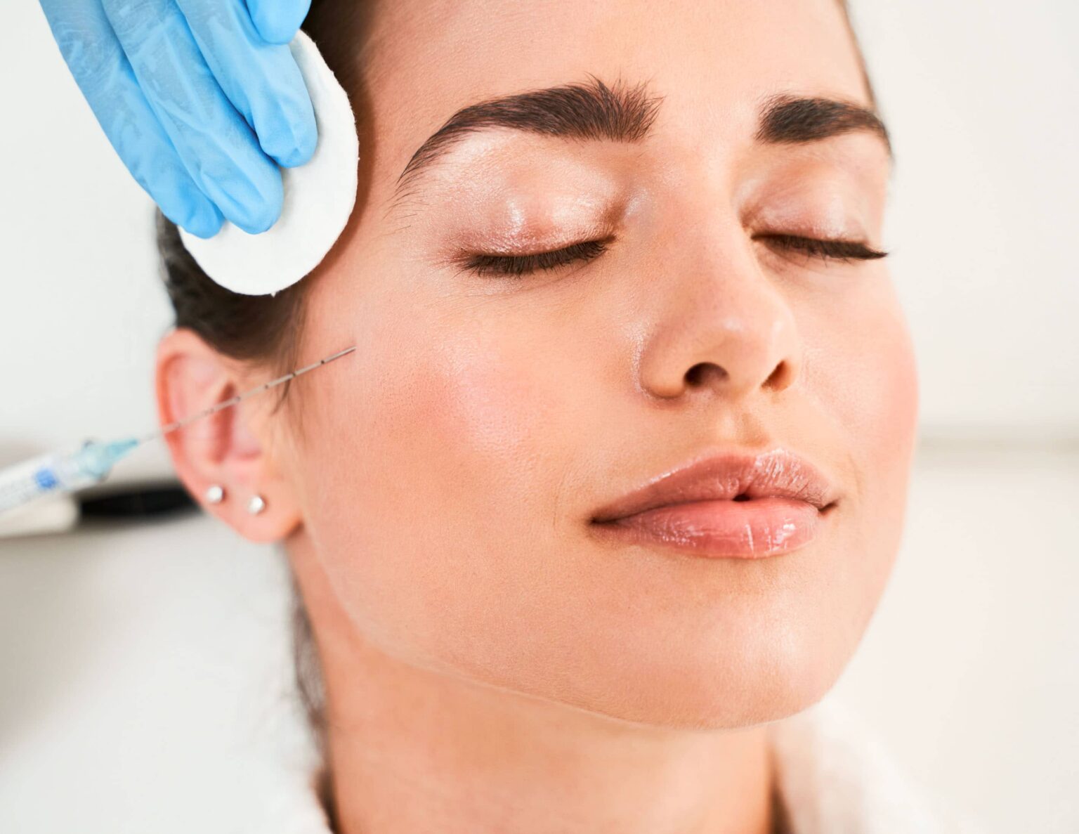 Injections d'acide hyaluronique pommettes | Dr Rivalier à Lyon